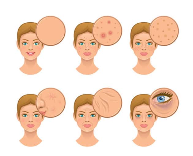 10 Health Problems You Can Detect Just By Looking At The Skin On Your ...