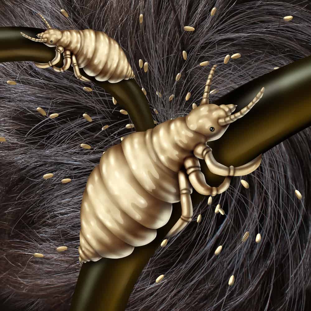 How To Protect Your Family From The New 'super Lice' Outbreak - FamilyToday