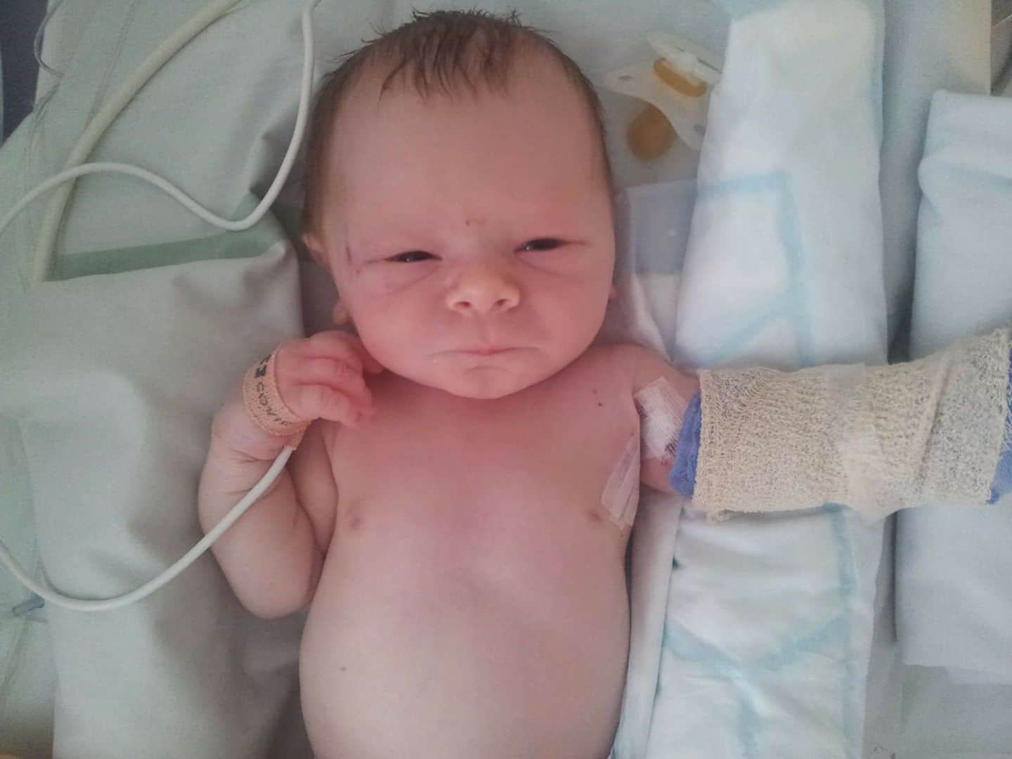 Baby Born With Blood Clot Loses His Arm At 10-days-old; Father Goes Mad ...